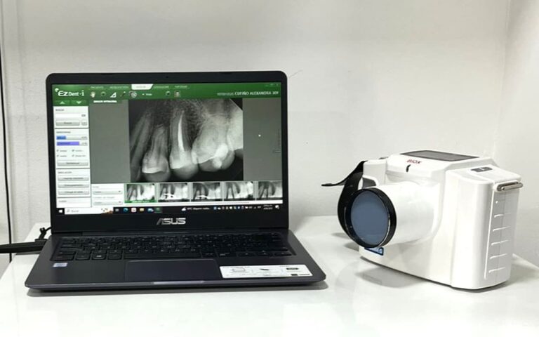Radiografía periapical – Dental Tourism Solutions